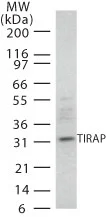 Anti-TIRAP antibody [20D1055] (ab13684) | Abcam