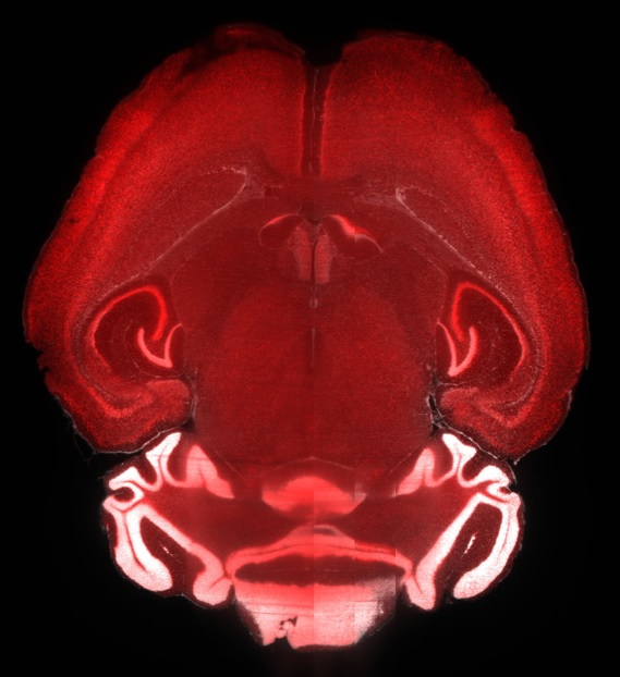 Tissue Clearing Kit – CUBIC (ab316246) | Abcam