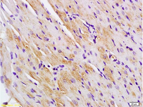 Anti-Titin antibody (ab203623) | Abcam