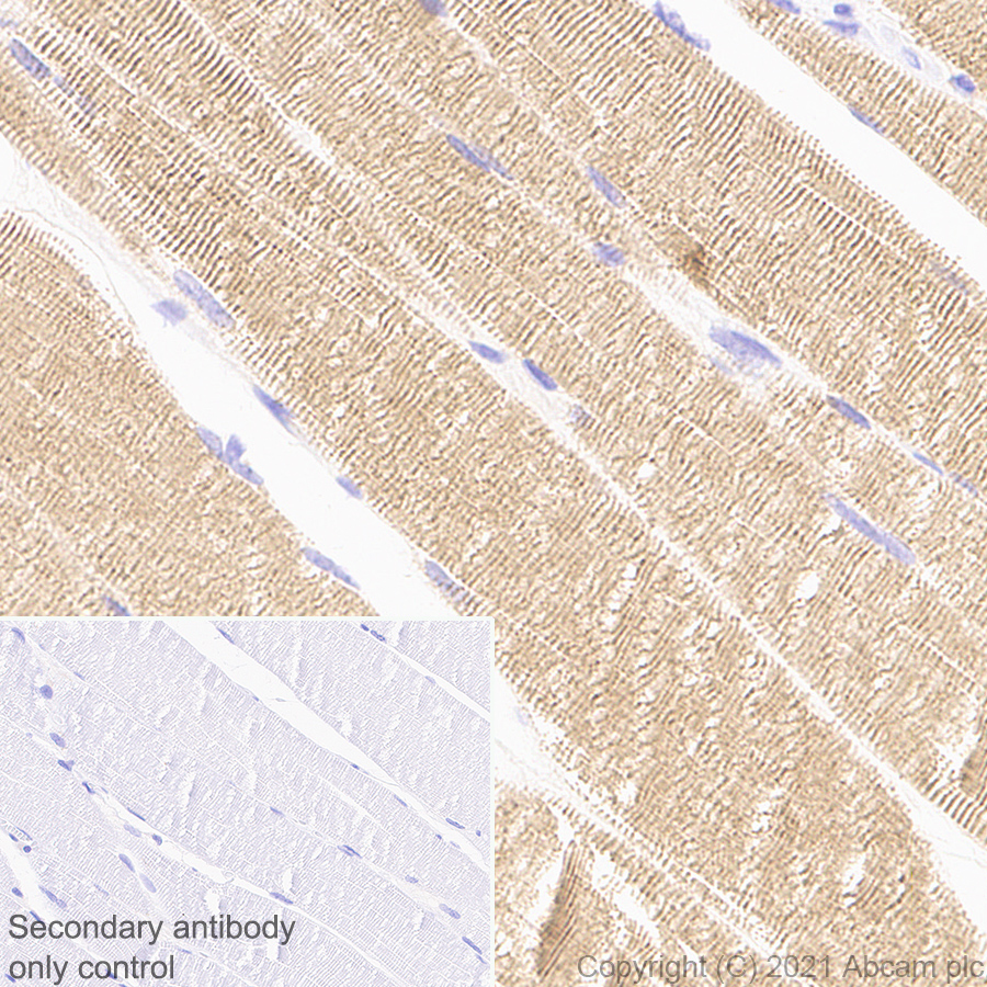 Anti-Titin antibody [EPR24455-21] 20 ul size (ab284860) | Abcam