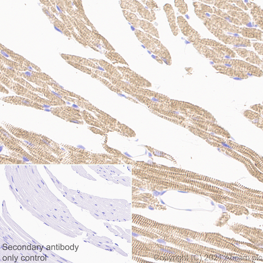 Anti-Titin antibody [EPR24455-21] 20 ul size (ab284860) | Abcam