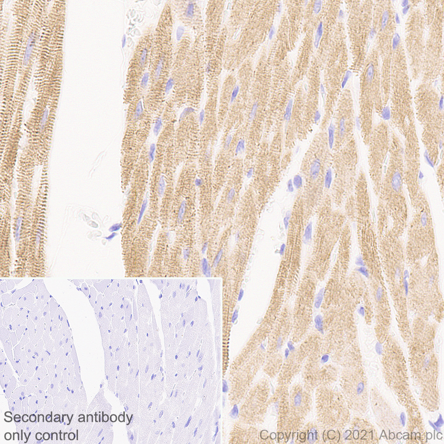 Anti-Titin antibody [EPR24455-21] 20 ul size (ab284860) | Abcam