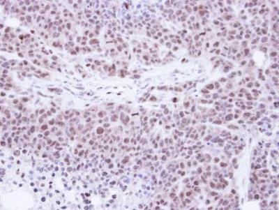 Anti-TKTL1/TKR antibody (ab155662) | Abcam