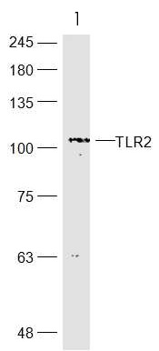Anti-TLR2 antibody. Rabbit polyclonal (ab213676) | Abcam