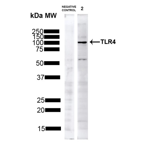 Anti-TLR4 antibody - rabbit polyclonal (ab13556) | Abcam