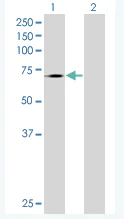 TLR4 overexpression 293T lysate (whole cell) (ab94063) | Abcam