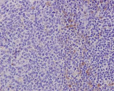 Anti-TLR7 antibody [EPR2088(2)] Rabbit monoclonal (ab124928) | Abcam