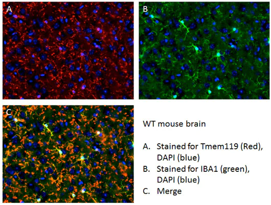 Anti-TMEM119 antibody [28-3] - microglial marker (ab209064) | Abcam