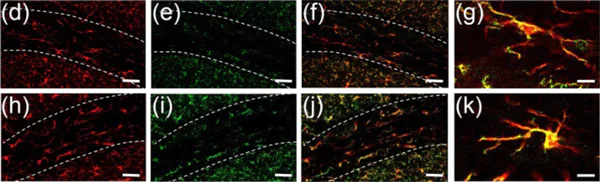TMEM119抗体[28-3] - Microglial marker (ab209064)| Abcam中文官网