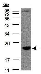 Anti-TMEM147 antibody (ab97624) | Abcam