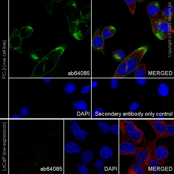 Anti-TMEM16A antibody [SP31] (ab64085) | Abcam