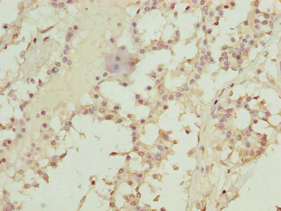 TMEM19抗体 (ab236852)| Abcam中文官网