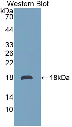 Anti-Tmem27 antibody (ab233531) | Abcam