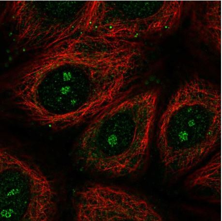 Anti-TMEM79 antibody - N-terminal (ab185453) | Abcam