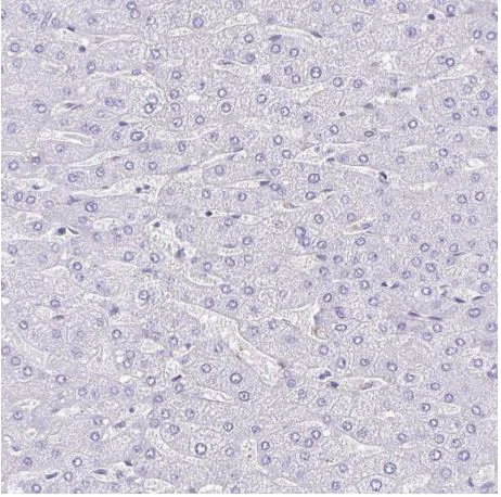 Anti-TMEM79 antibody - N-terminal (ab185453) | Abcam
