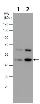 TMPRSS13抗体- Cytoplasmic domain (ab59862)| Abcam中文官网