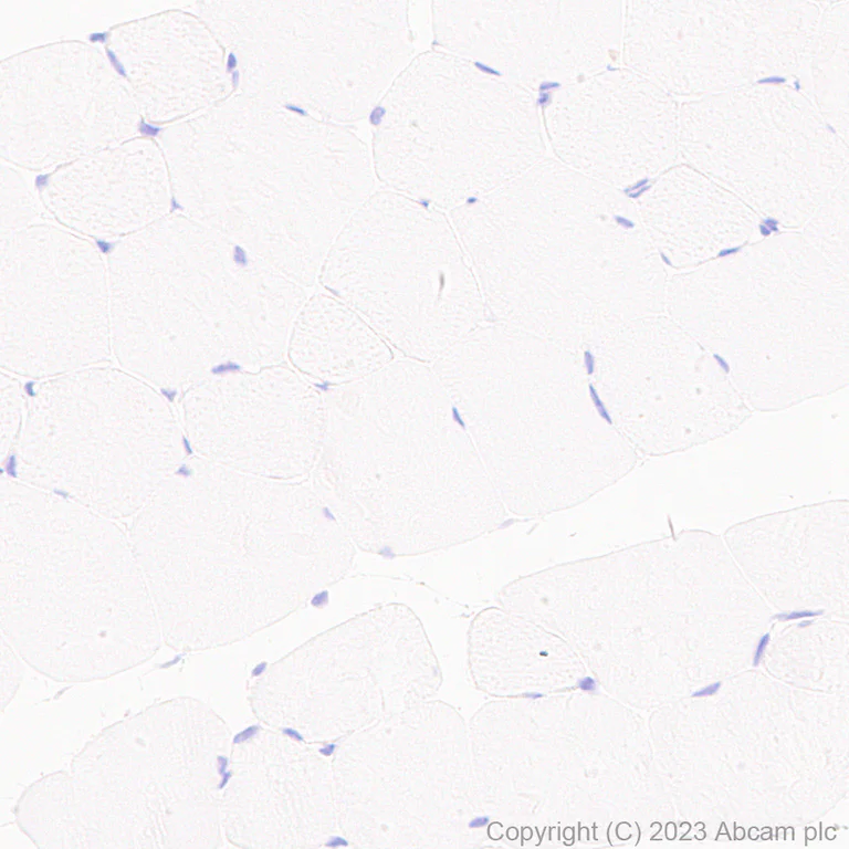 TMS1/ASC抗体[RM1049] (ab309497)| Abcam中文官网