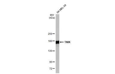 Anti-TNIK antibody [HL1751] (ab308194) | Abcam