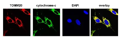 TOMM20抗体[EPR15581-54] - Mitochondrial Marker (ab186735)| Abcam中文官网