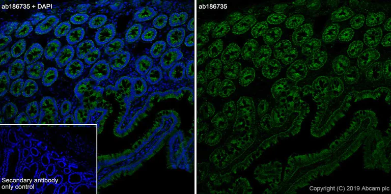 Anti-TOMM20 antibody [EPR15581-54] (ab186735) | Abcam