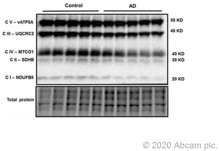 Total OXPHOS Rodent WB Antibody Cocktail. (ab110413) | Abcam