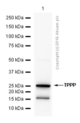 Anti-TPPP antibody [EPR3315] (ab119987) | Abcam