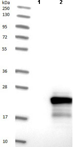 Anti-TPPP2 antibody (ab121215) | Abcam