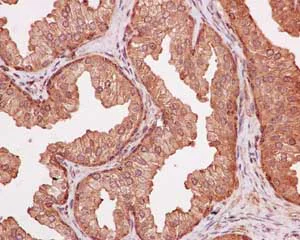 Anti-TPT1L + TCTP antibody [EPR13882(B)] - BSA and Azide free (ab250615 ...