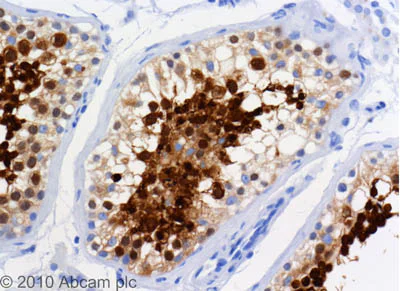 Anti-TPX2 antibody [18D5-1] (ab32795) | Abcam