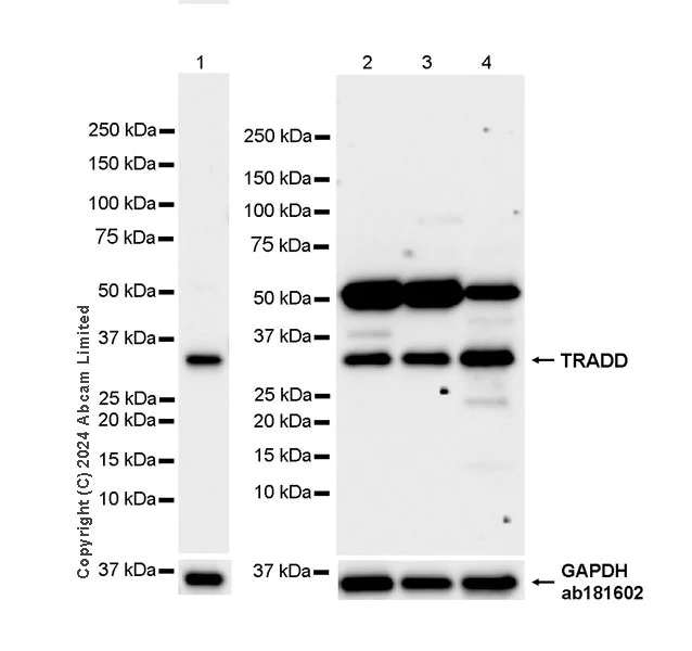 Anti-TRADD antibody [EPR27061-75] (ab319029) | Abcam