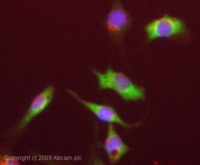 Anti-Transferrin antibody (ab47981) | Abcam