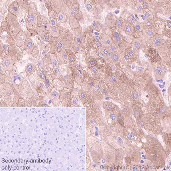 Anti-Transferrin antibody [EPR2932(2)] (ab109503) | Abcam