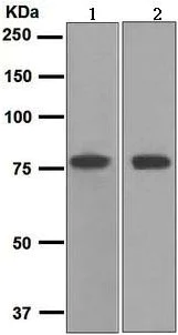 Anti-Transferrin antibody [EPR2932(2)] (ab109503) | Abcam