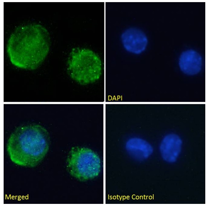 Anti-Transferrin antibody [TF/3001] (ab268117) | Abcam