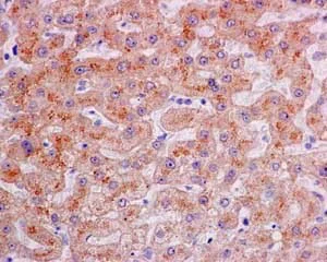 Anti-Transferrin Receptor 2/TFR2 antibody [EPR15322] (ab185550) | Abcam