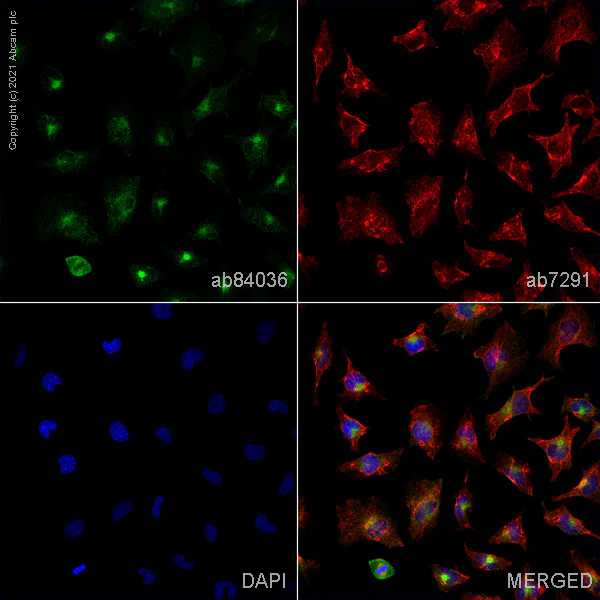 Transferrin Receptor抗体 (ab84036)| Abcam中文官网
