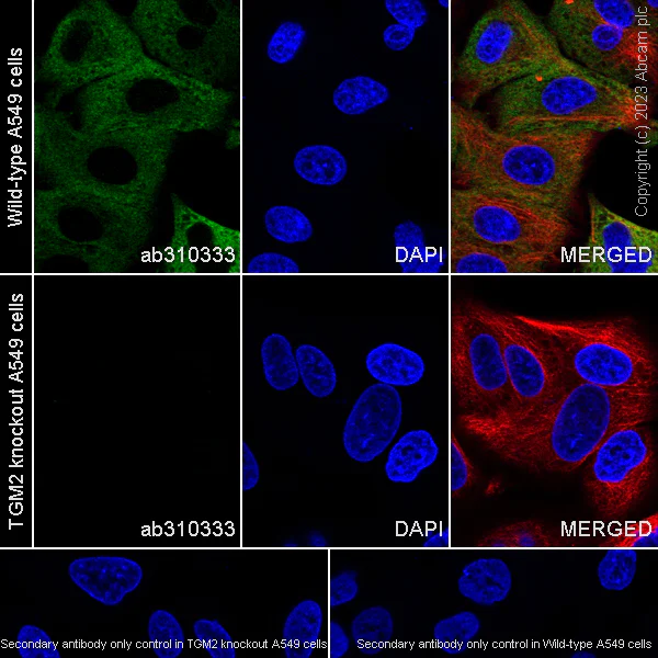 Transglutaminase 2抗体[EPR28142-86] (ab310333)| Abcam中文官网