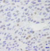 Anti-TRAP220/MED1 antibody (ab84386) | Abcam