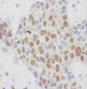 Anti-TRAP220/MED1 antibody (ab84386) | Abcam