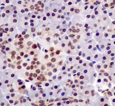 Anti-TRAP220/MED1 (phospho T1457) antibody [EPR13269] (ab181103) | Abcam