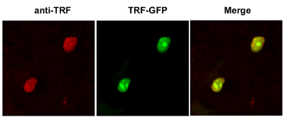 Anti-TRF1 antibody (ab1423) | Abcam