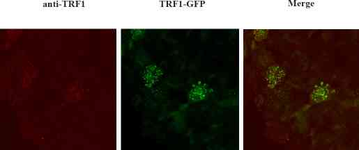 Anti-TRF1 antibody (ab1423) | Abcam
