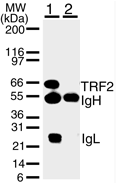 Anti-TRF2 antibody [4A794] (ab13579) | Abcam