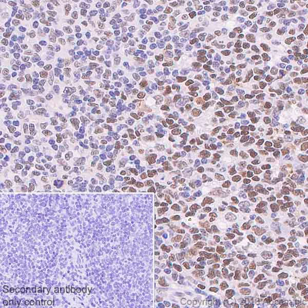 Anti-TRF2 antibody [EPR3517(2)] Rabbit monoclonal (ab108997) | Abcam