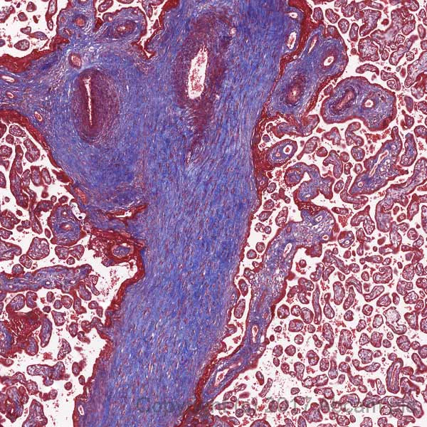 Trichrome Stain Kit (Connective Tissue Stain) (ab150686) | Abcam
