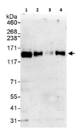 Anti-TRIM24 antibody [EPR6102] (ab174287) | Abcam