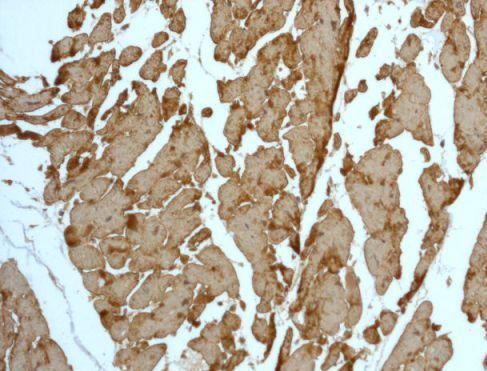 Anti-Tropomyosin 1 (alpha) + Tropomyosin 3 antibody [EPR5159] (ab133292 ...