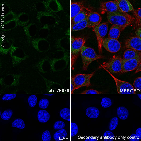 Anti-TRP1 antibody [EPR13063] (ab178676) | Abcam