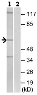 Anti-TRP2/DCT antibody (ab74073) | Abcam