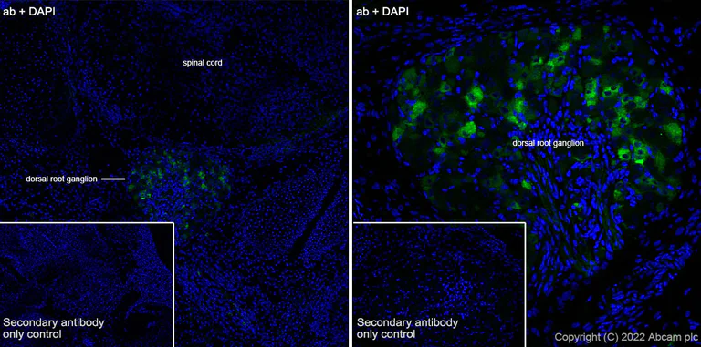 Anti-TRPV1 antibody [EPR25057-67] (ab305299) | Abcam